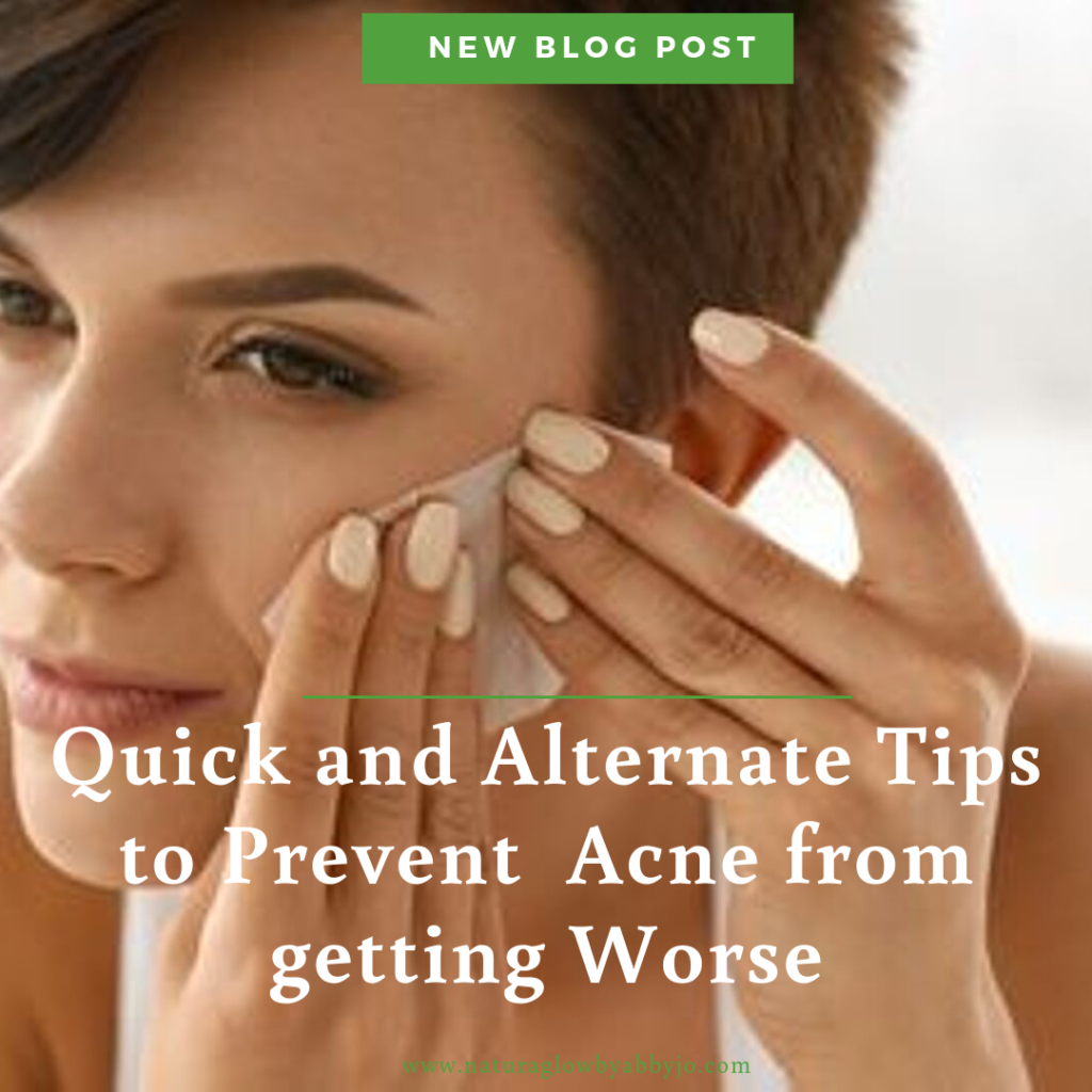 Quick and Alternate Tips to Prevent Acne from getting worse ...
