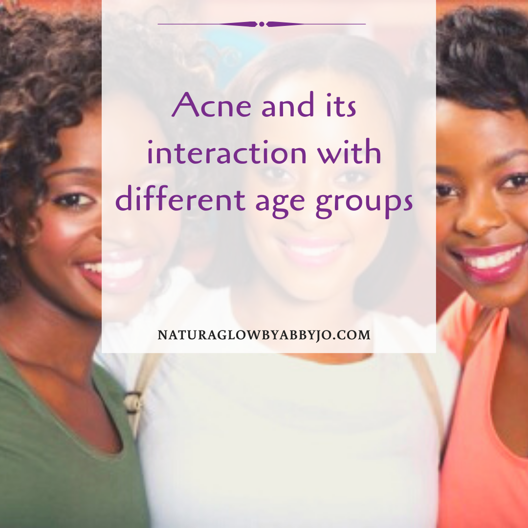 Acne and its Interaction with different Age groups - NaturaGlow Blog